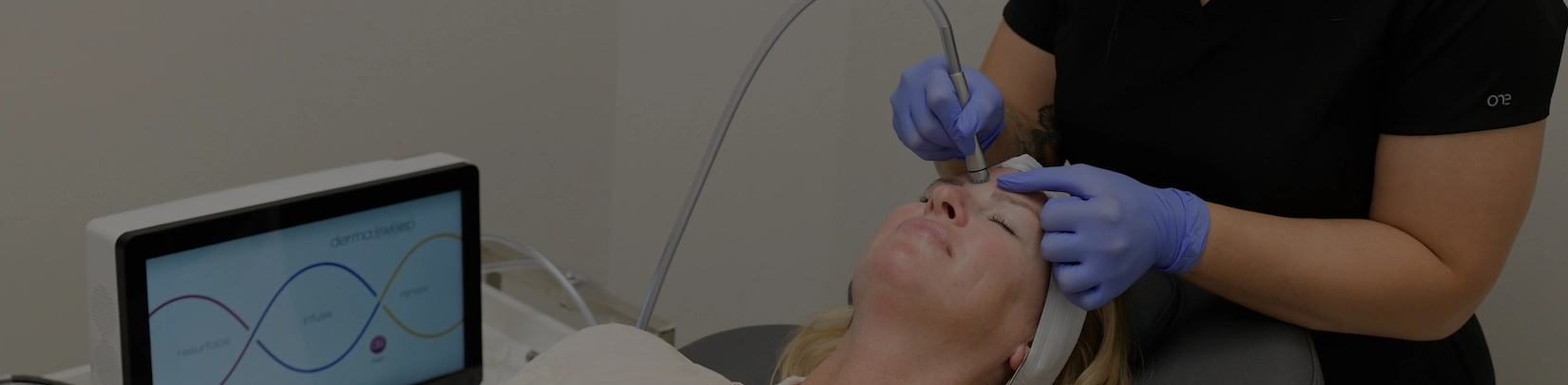 DermaSweep Camarillo Ventura CA | beyond|AESTHETICS