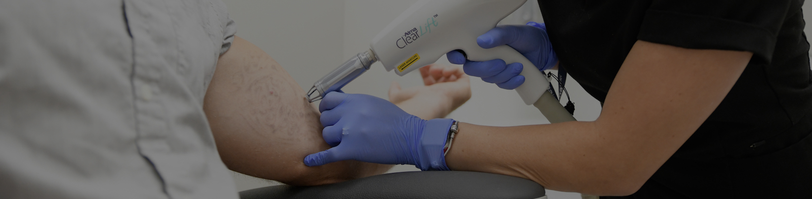 Tattoo Removal Camarillo and Ventura CA | beyond|AESTHETICS